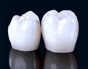 Dental Crowns Brooklyn - CEREC, PFZ, Zirconium, Ceramic Crowns